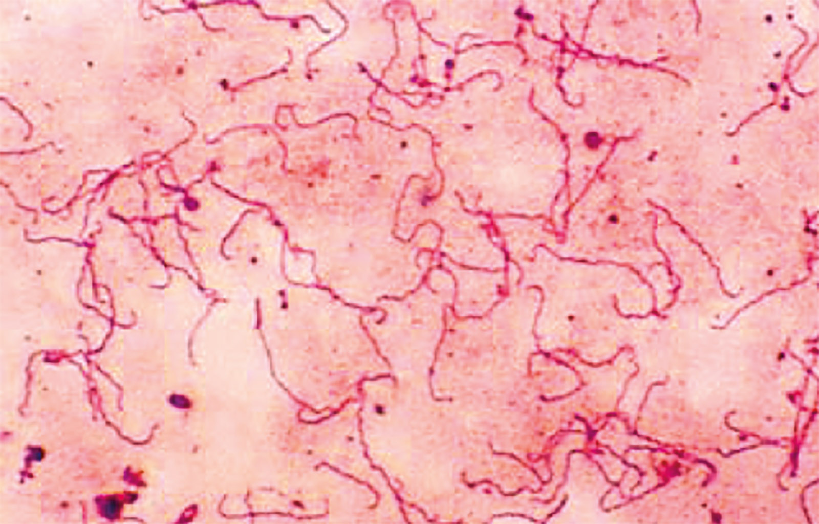 Oral syphilis – A case report : Ireland's Dental Magazine